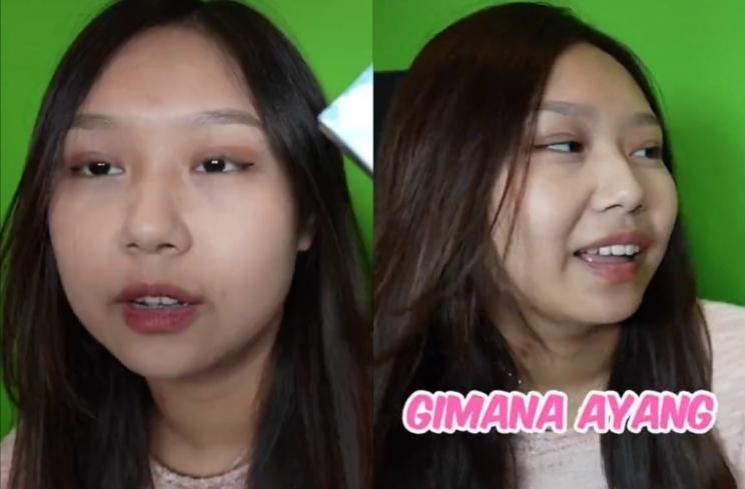 Cupang di Leher Sisca Kohl Bikin Salfok saat Umumkan Hamil: Terlalu Brutal